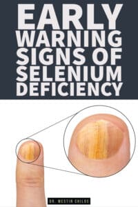8 Early Symptoms of Selenium Deficiency & Your Next Steps