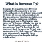 How to Treat High Reverse T3 Levels