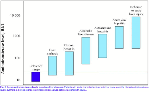 Top Causes of Elevated Liver Enzymes - Lower Your AST and ALT