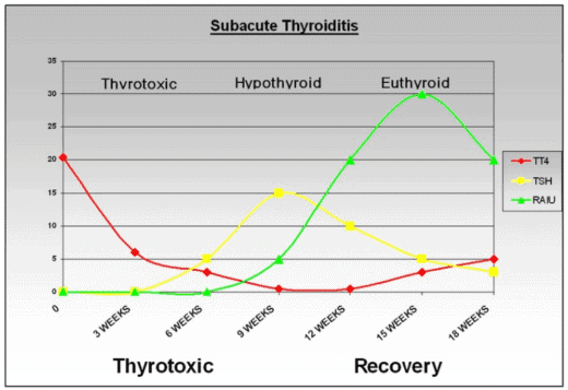 What is Thyroiditis? Types, Symptoms & Treatment (Patient Guide)