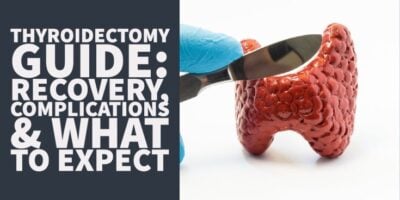 Thyroidectomy Guide: Recovery, Complications & What to Expect