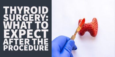 Thyroid Surgery: FAQ & What to Expect After the Procedure