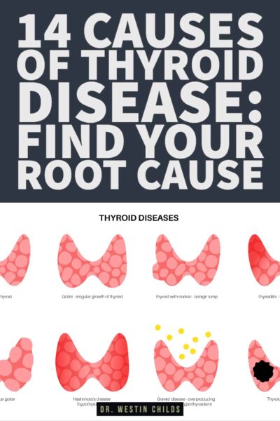 What Causes Thyroid Disease? 14 Common Reasons Listed