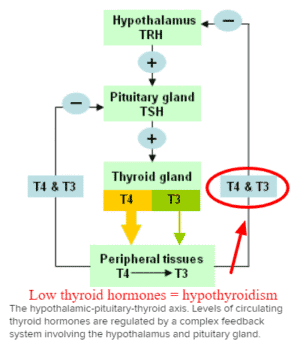 Hypothyroid vs Hashimoto's: What's the difference?