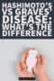 Hashimoto’s vs Graves’ Disease: Differences & Similarities