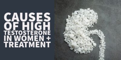 6 Causes of High Testosterone in Women