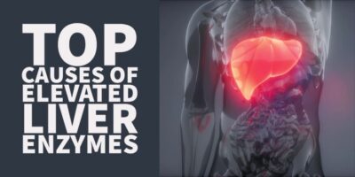 Top Causes of Elevated Liver Enzymes (AST & ALT)