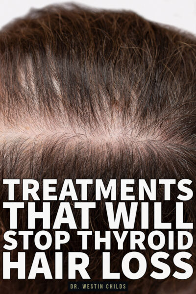 7 Treatments That Will Stop Thyroid Hair Loss