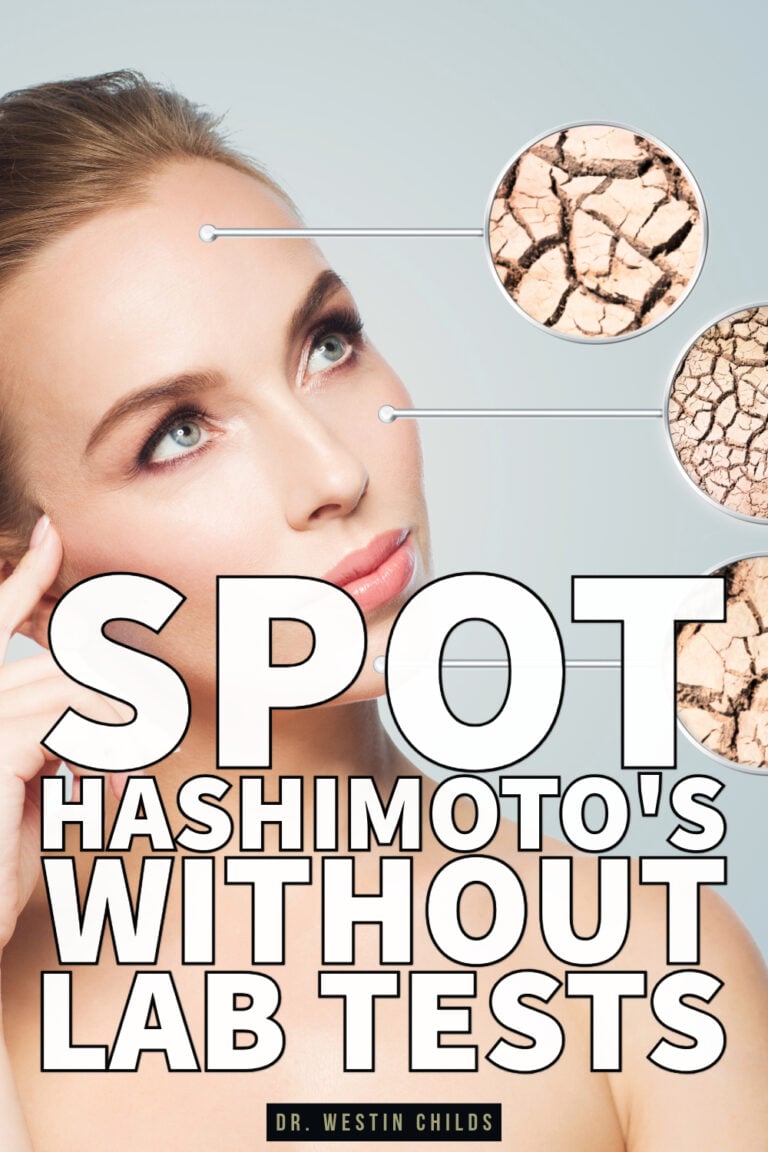 Spot Hashimoto’s Without Lab Tests. Look For These 8 Signs.